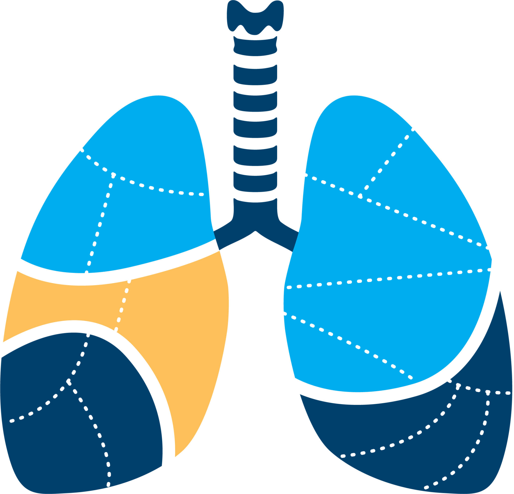 Lung Cancer Treatments | Lung Cancer Research Foundation